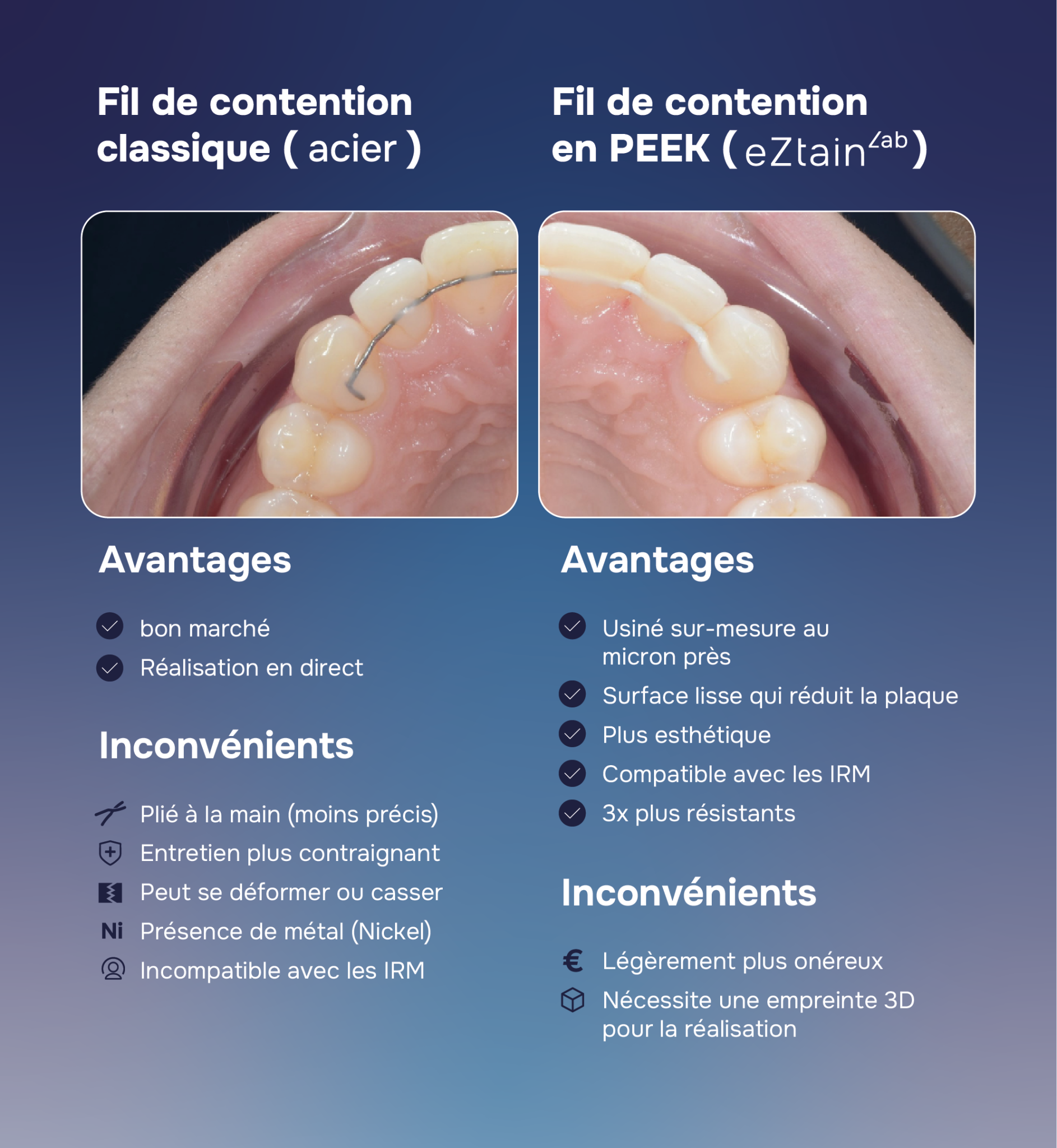 Orthodontic fixed retainer – The Complete Guide | eZtain Lab