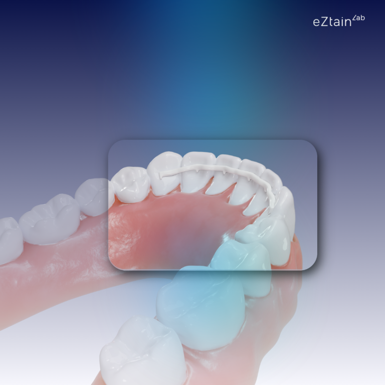Pose d’un fil de contention dentaire : procédure et conseils | eZtain Lab